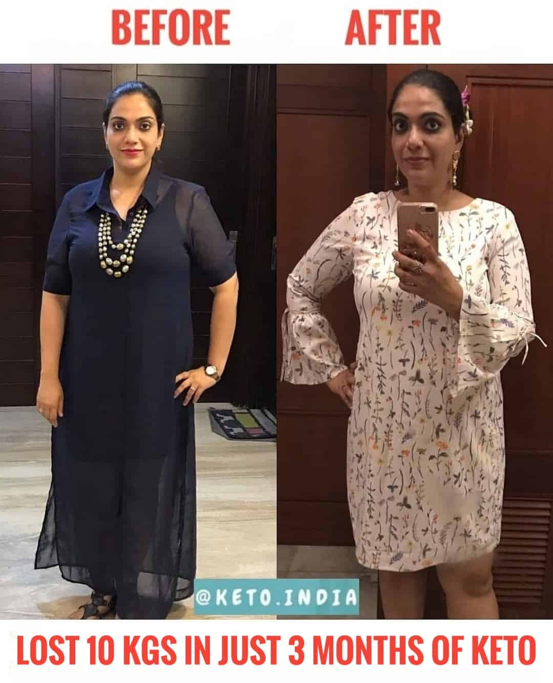 Weight Loss Keto Transformation Story Of Himani | Keto Diet | Keto India