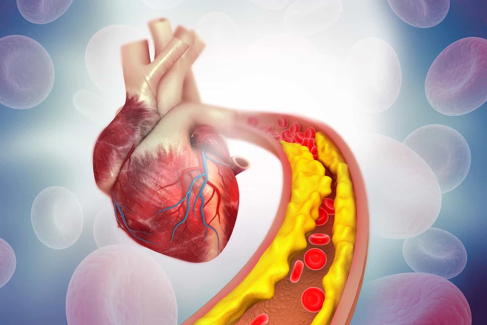 Cholesterol: Overview, LDL, HDL And It's Link With Keto | Keto India Cholesterol: Overview, LDL, HDL And It's Link With Keto | Keto India