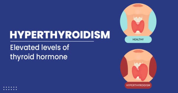 Hyperthroidism - Meaning, Symptoms, Causes & Risk Factors | Livofy