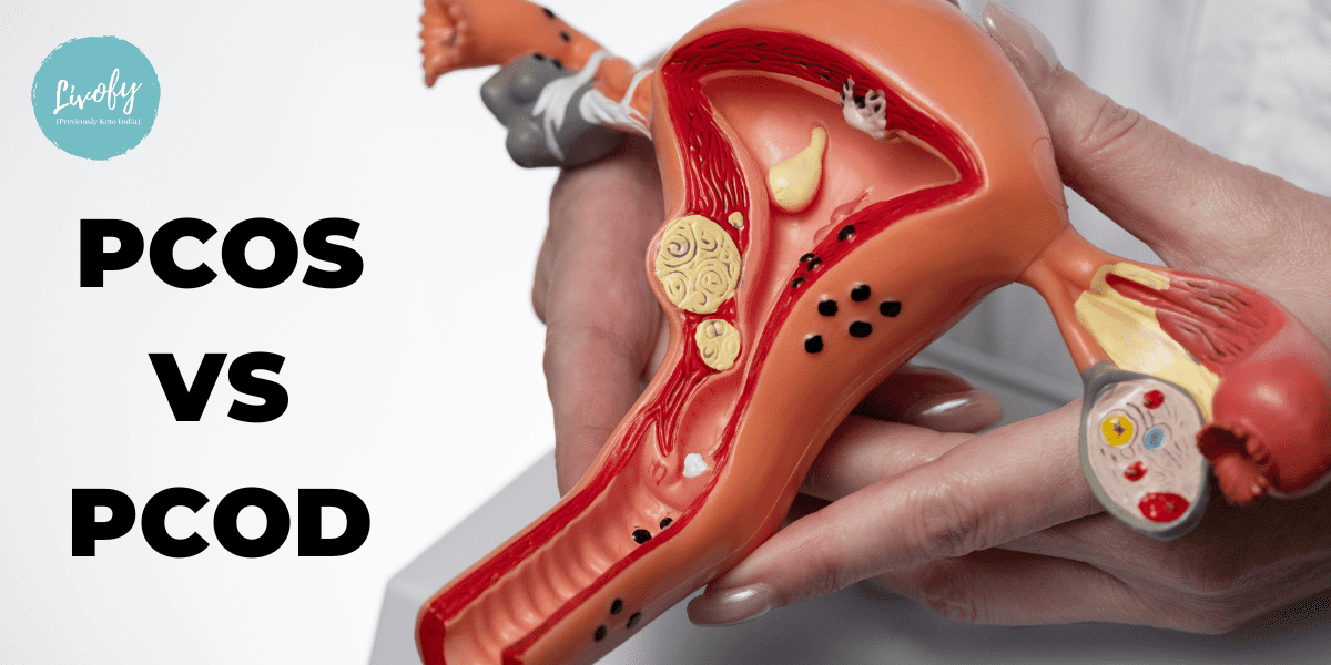 PCOS vs PCOD: Understanding Differences with Examples | Livofy