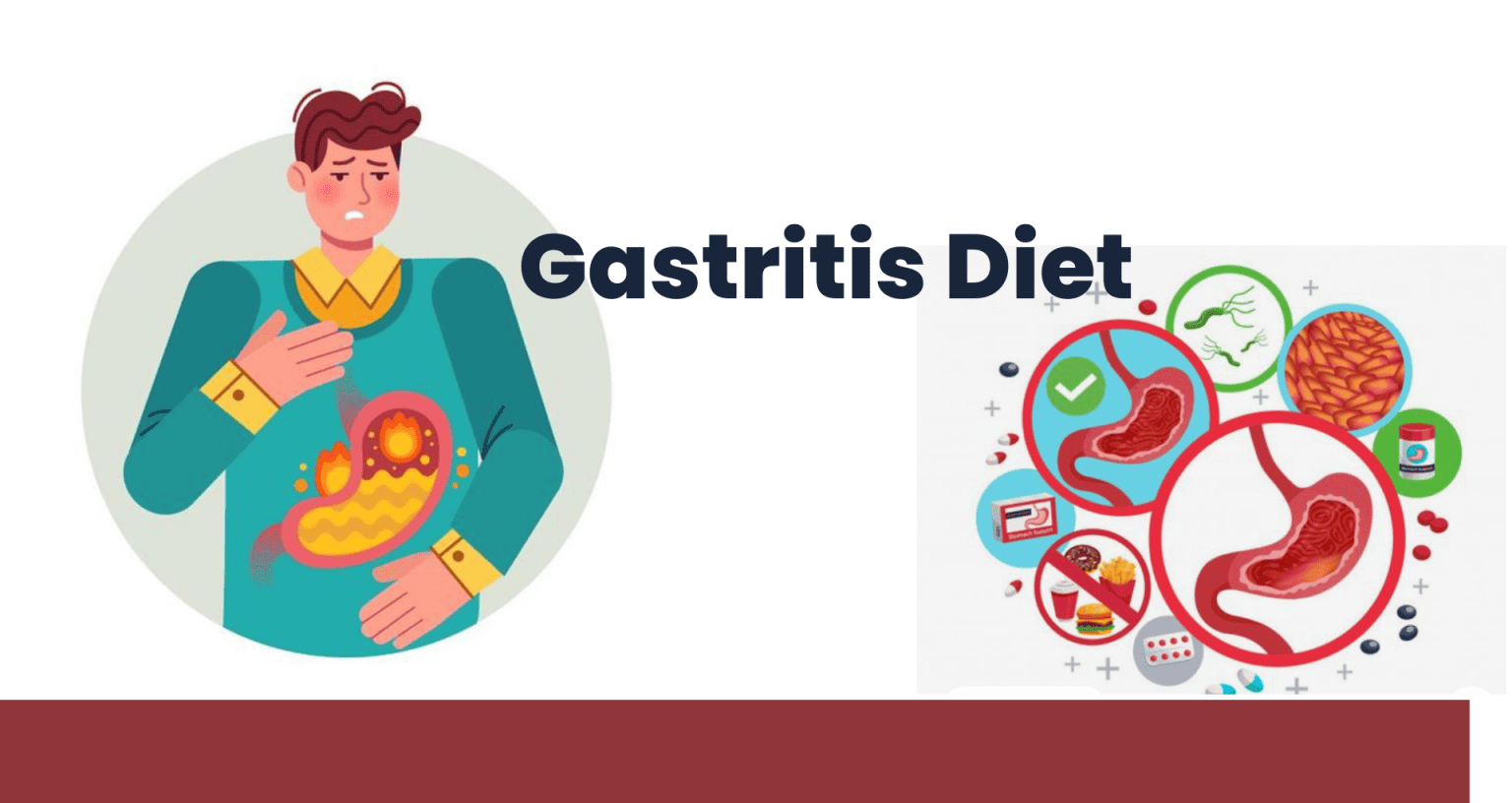 Gastritis Diet: Foods to Avoid & Eat with Diet Plan | Livofy